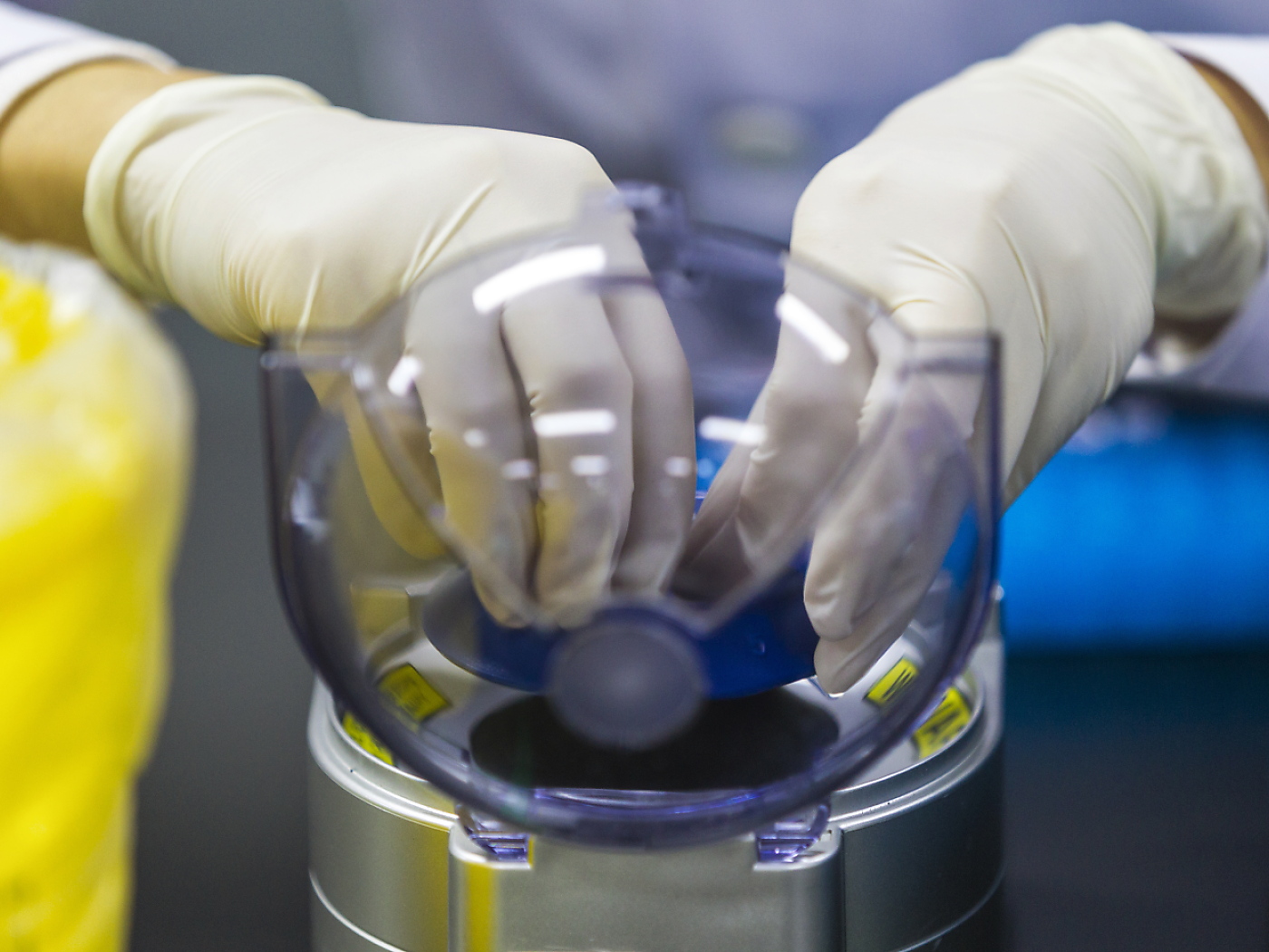 Swiss researchers identify gene variants linked to cancer progression ...